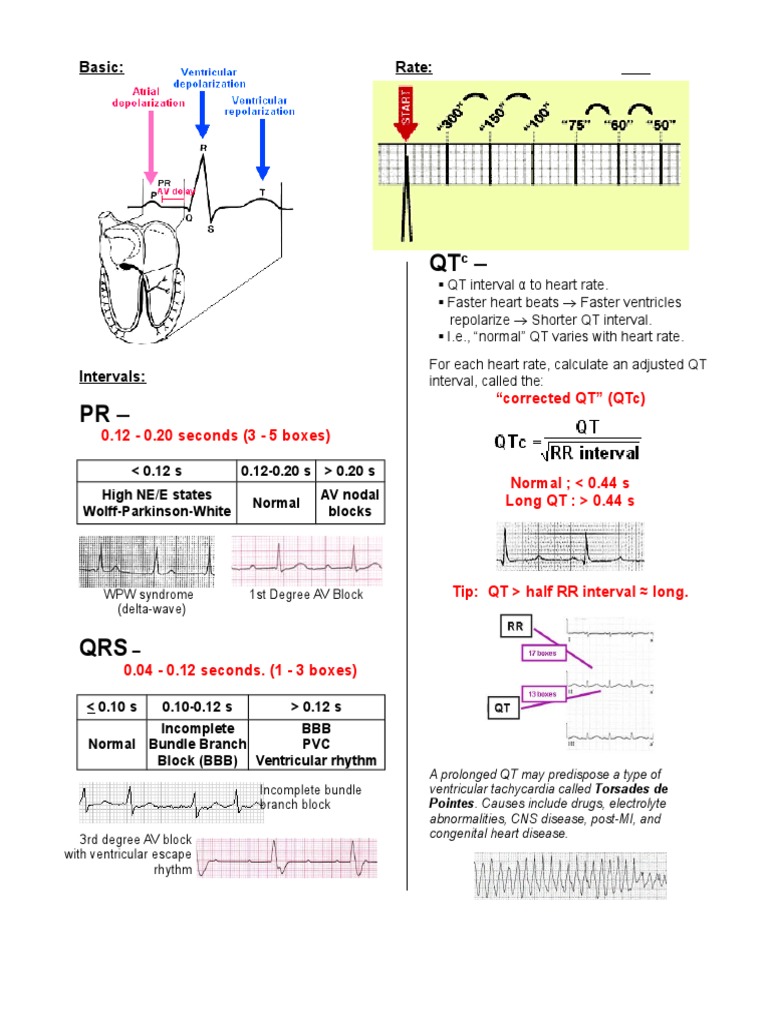 A Simplified ECG Guide | PDF | Electrocardiography | Internal Medicine