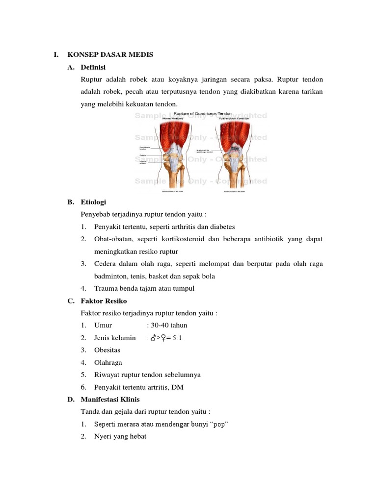 LP Ruptur Tendon | PDF | Sains & Matematika