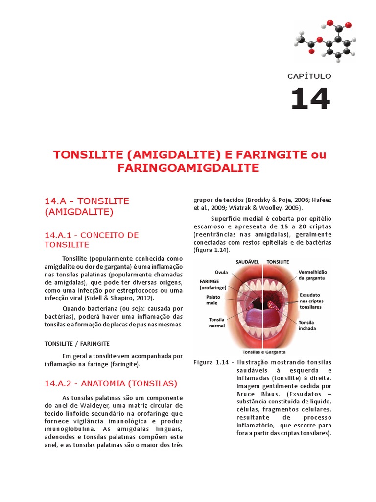 Tonsilite Faringite | PDF | Imunologia | Remédio