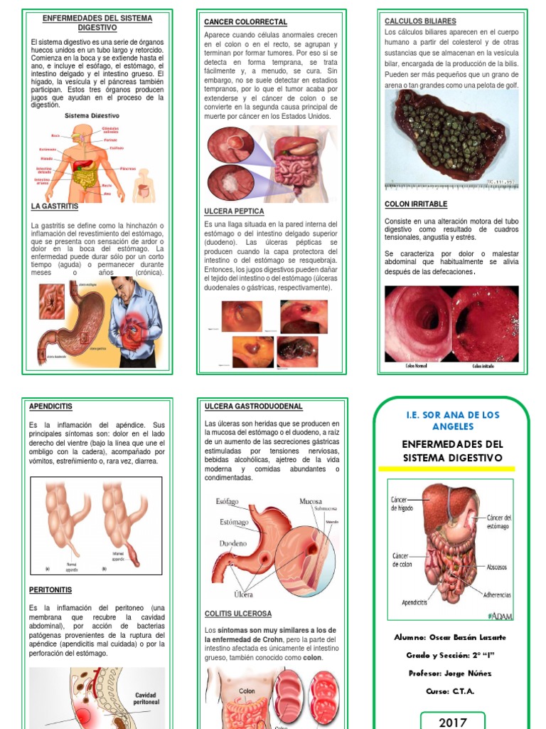 TRIPTICO ENFERMEDADES DIGESTIVAS | Sistema digestivo humano | Estómago