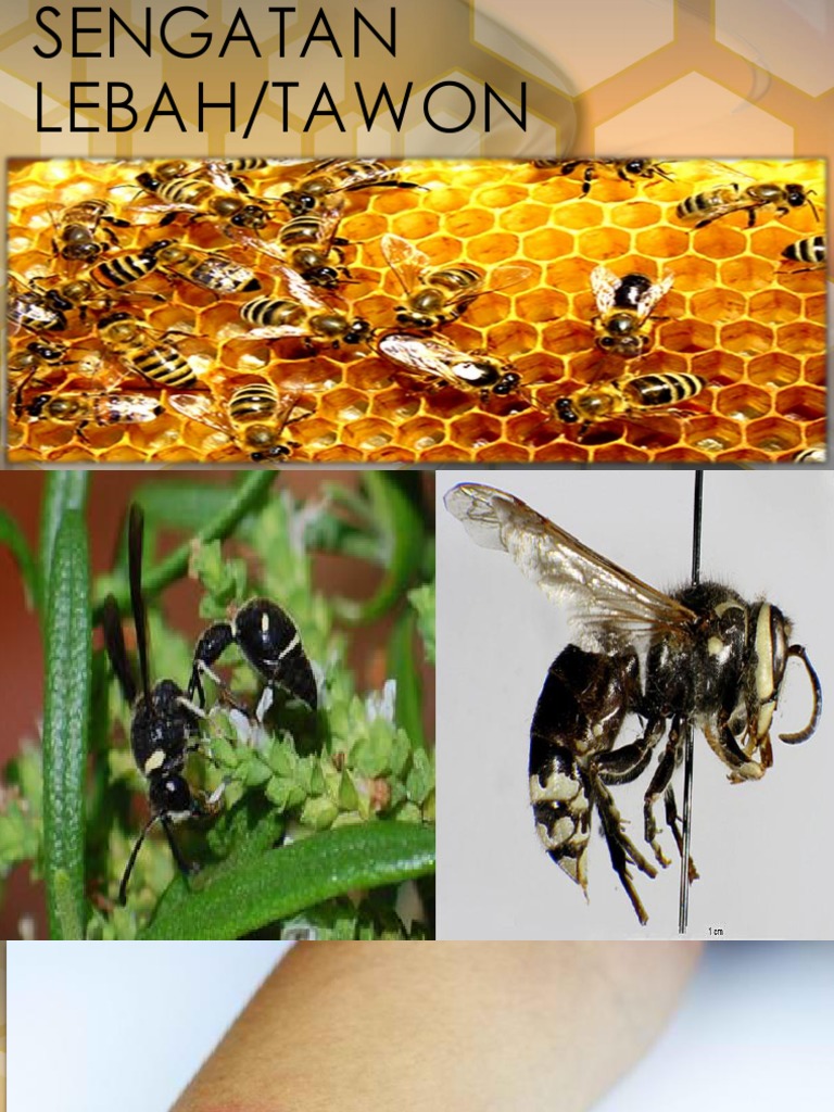 Sengatan Lebah | PDF