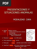 Distocia Funicular: Definición y Evaluación | PDF | Parto | Feto