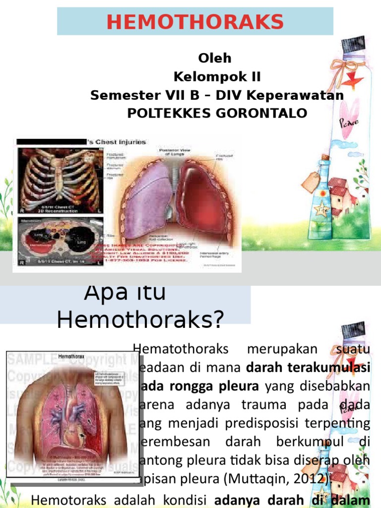 Hemothoraks | PDF