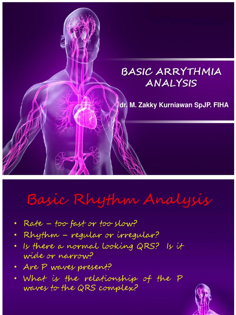 Basic Arrythmia Analysis | PDF | Cardiovascular Physiology ...
