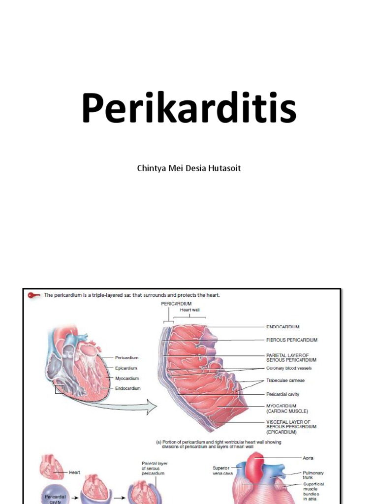 Perikarditis | PDF