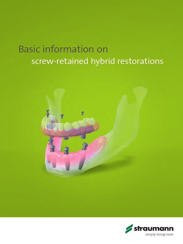 Straumann Screw Retained Hybrid Restorations | PDF | Dental Implant | Face