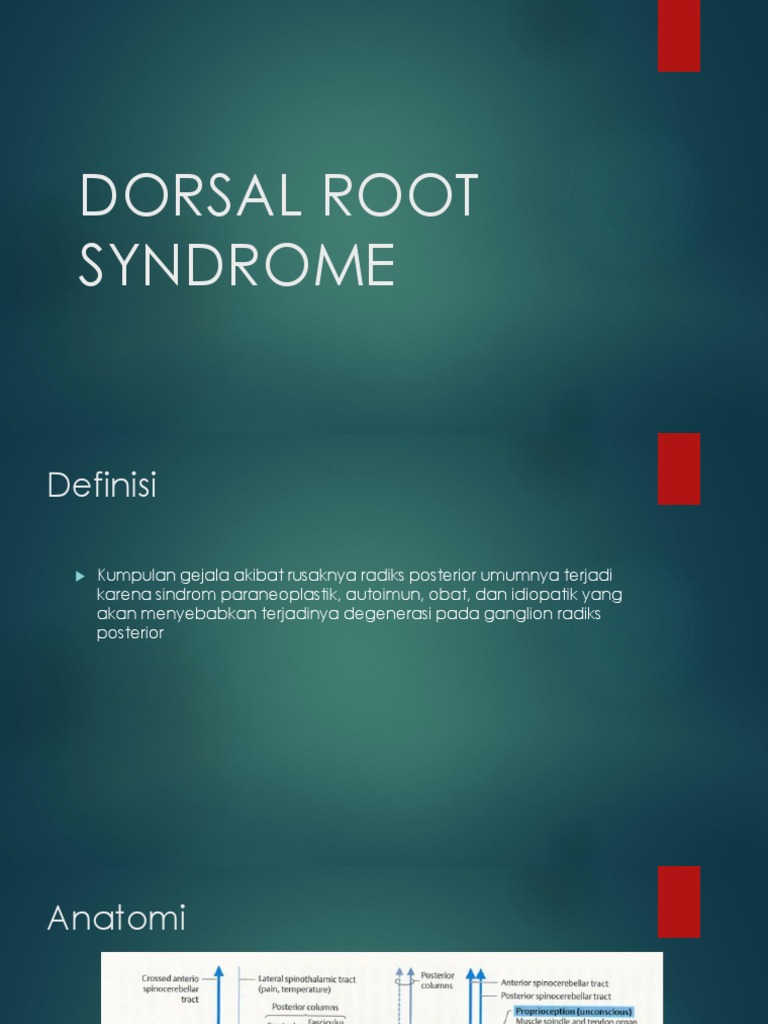 Dorsal Root Syndrome Slide | PDF