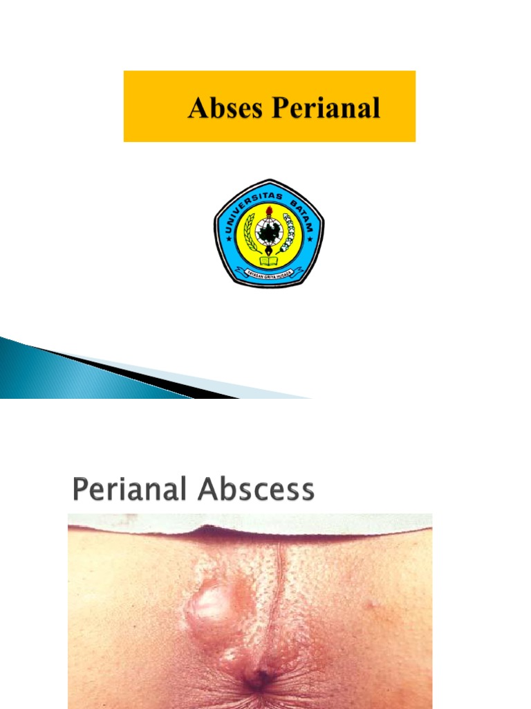 Abses Perianal | PDF | Ilmu Sosial