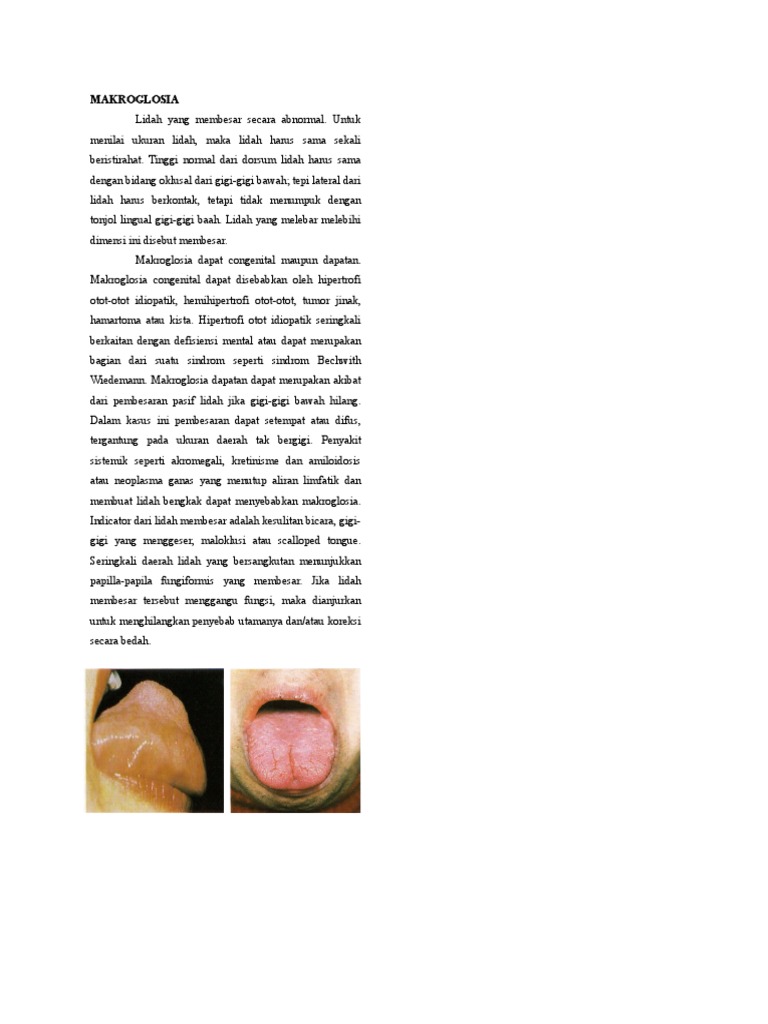Makroglossia | PDF | Sains & Matematika | Kesehatan Holistik
