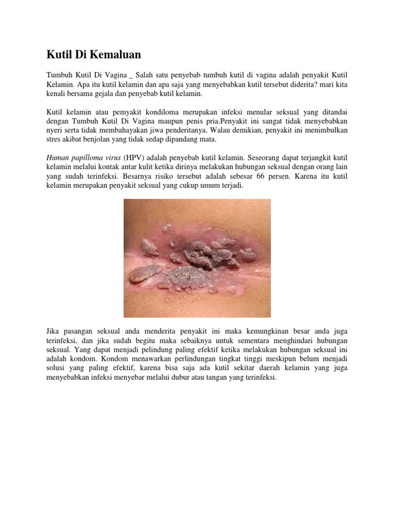 Penyebab Tumbuh Kutil Di Vagina Dan Cara Mengobatinya | PDF