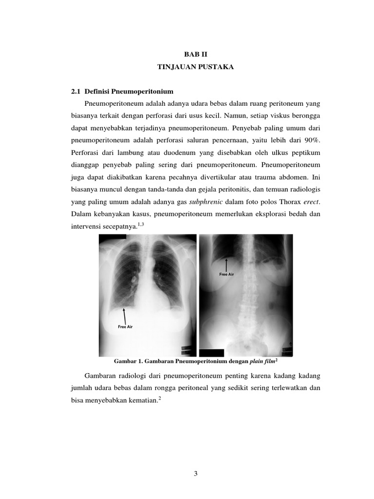 Referat Pneumoperitoneum | PDF | Sains & Matematika