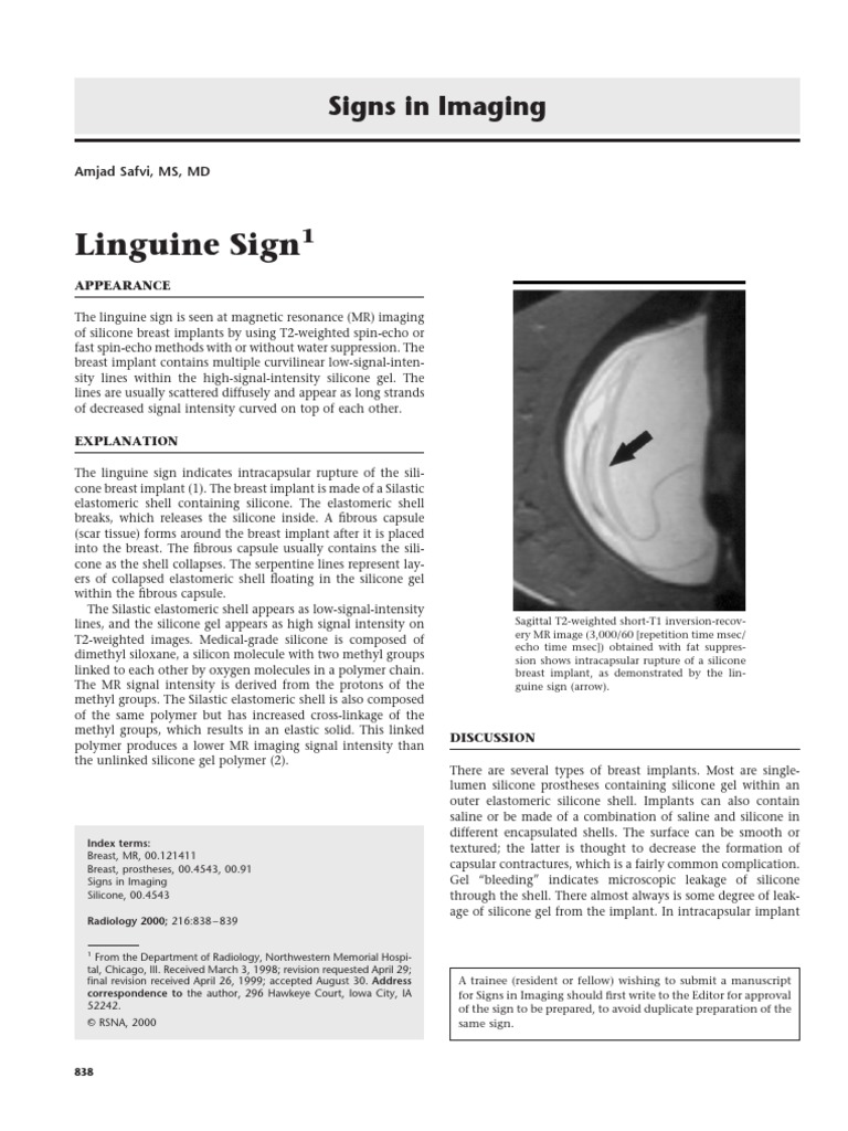 Linguine sign.pdf | Materials | Medical Specialties