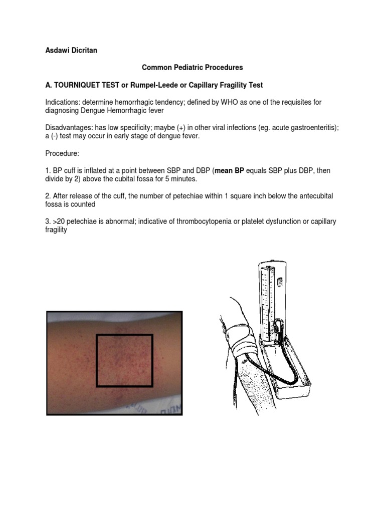 Tourniquet Test | PDF