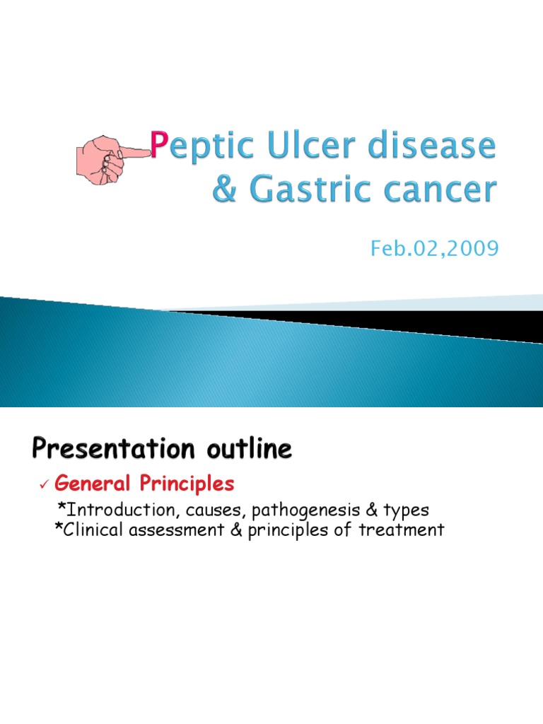 Peptic Ulcer Management | Indigestion | Surgery
