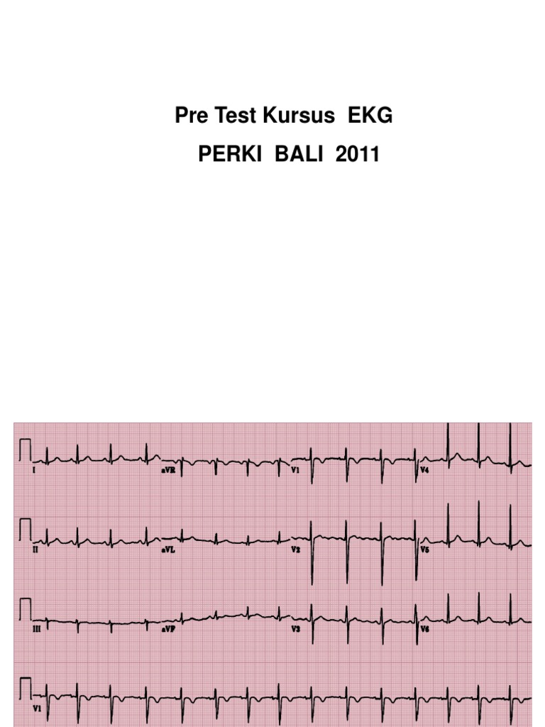 Pre Test Kursus EKG Perki Bali 2011 | PDF