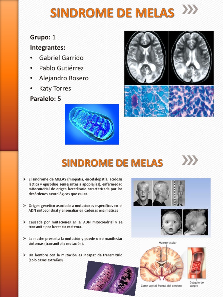 Sindrome de Melas | PDF | Trastorno genético | Mutación