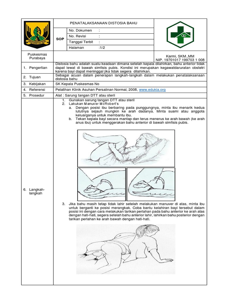 Sop Penatalaksanaan Distosia Bahu | PDF