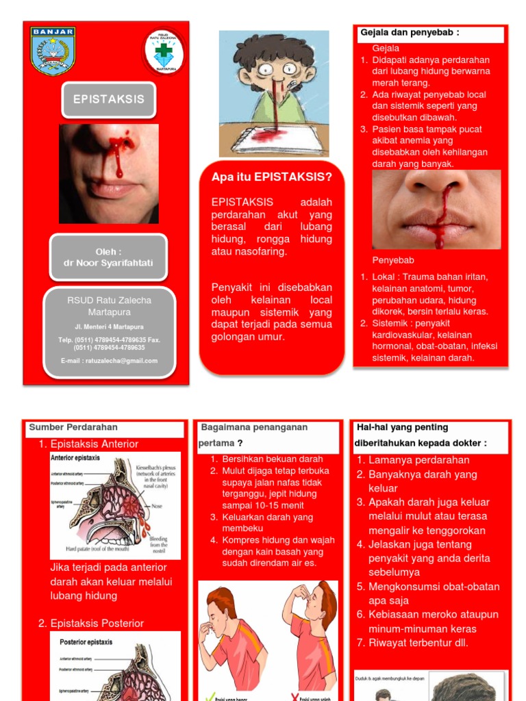 Epitaksis Leaflet (DR Noorsyarifahtati) | PDF