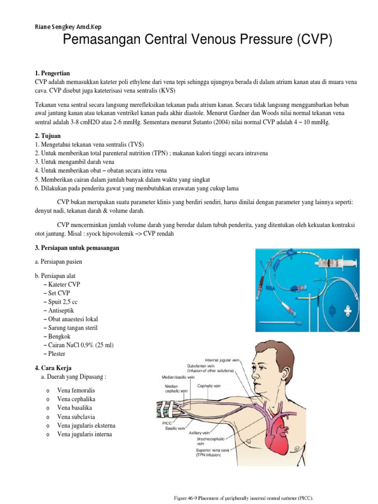 Pemasangan Central Venous Pressure (CVP) | PDF