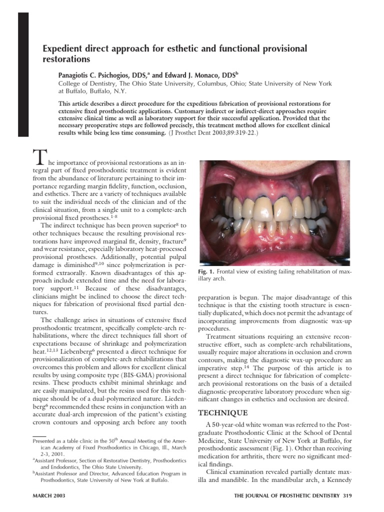 Provisional Restorations | PDF | Dentures | Prosthodontics
