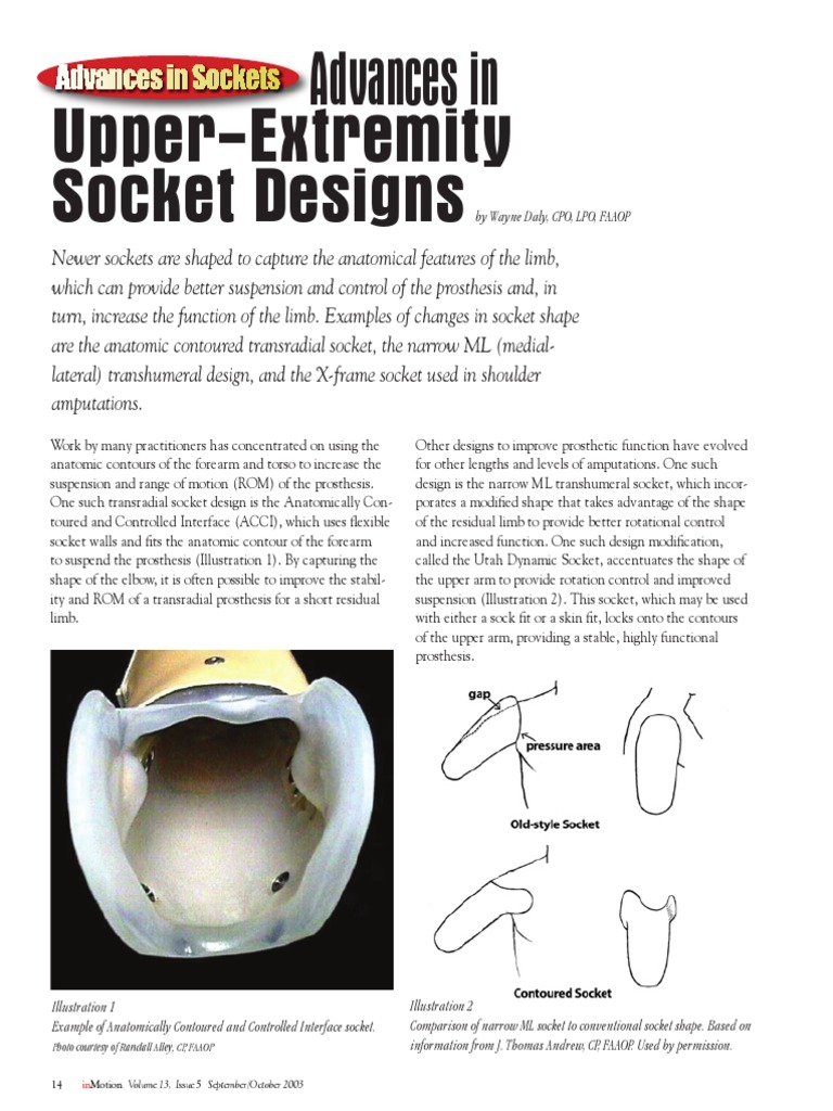 Sockets | Prosthesis | Nature