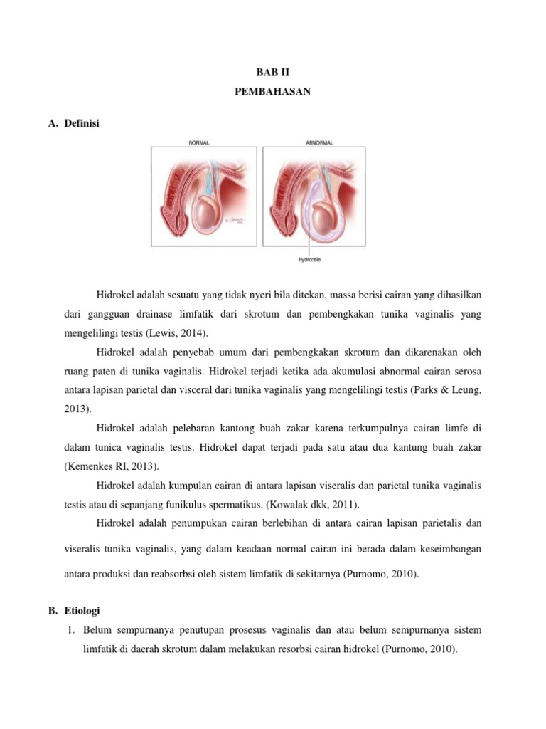 Penanganan dan Diagnosis Hidrokel | PDF
