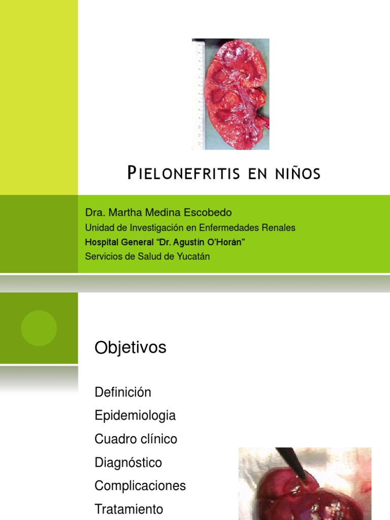 Pielonefritis_en_ninios.pdf