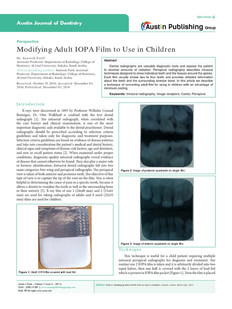 Modifying Adult Iopa | Radiography | Dentistry