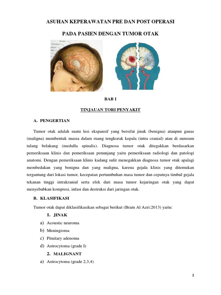 Askep Tumor Otak | PDF