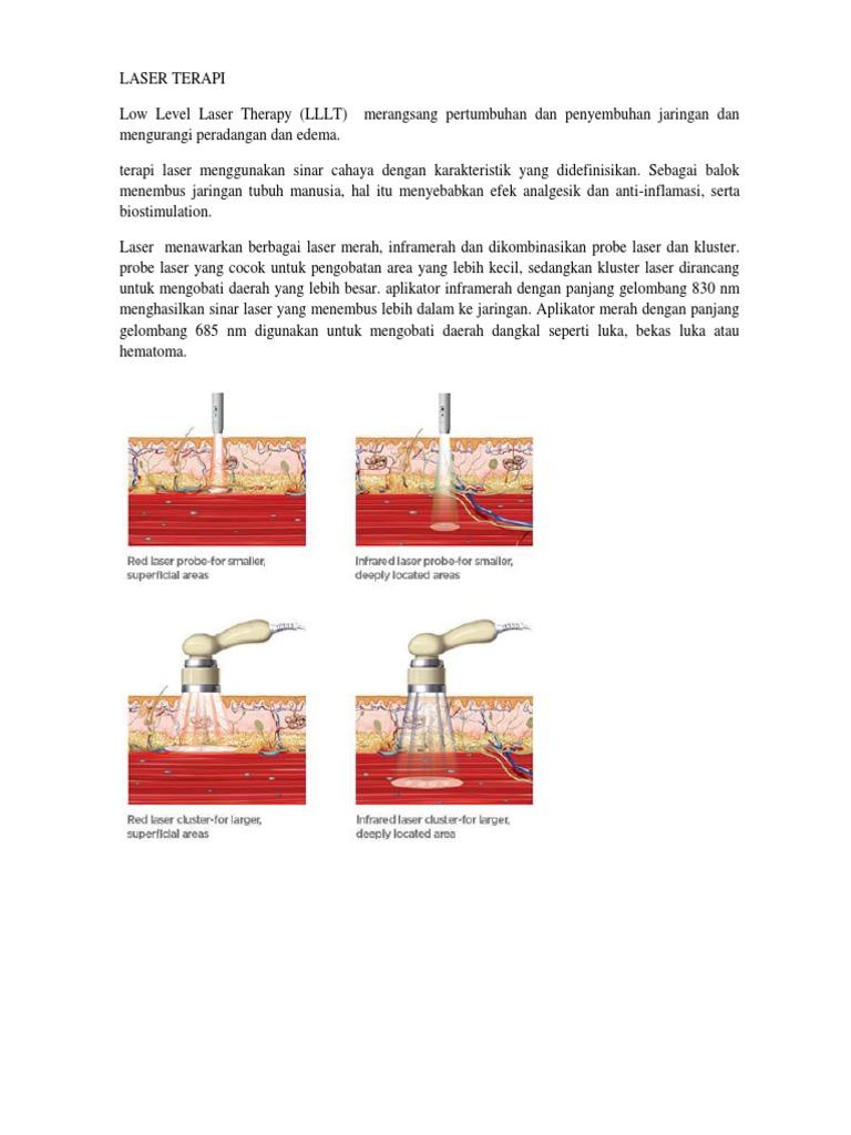 Laser Terapi | PDF