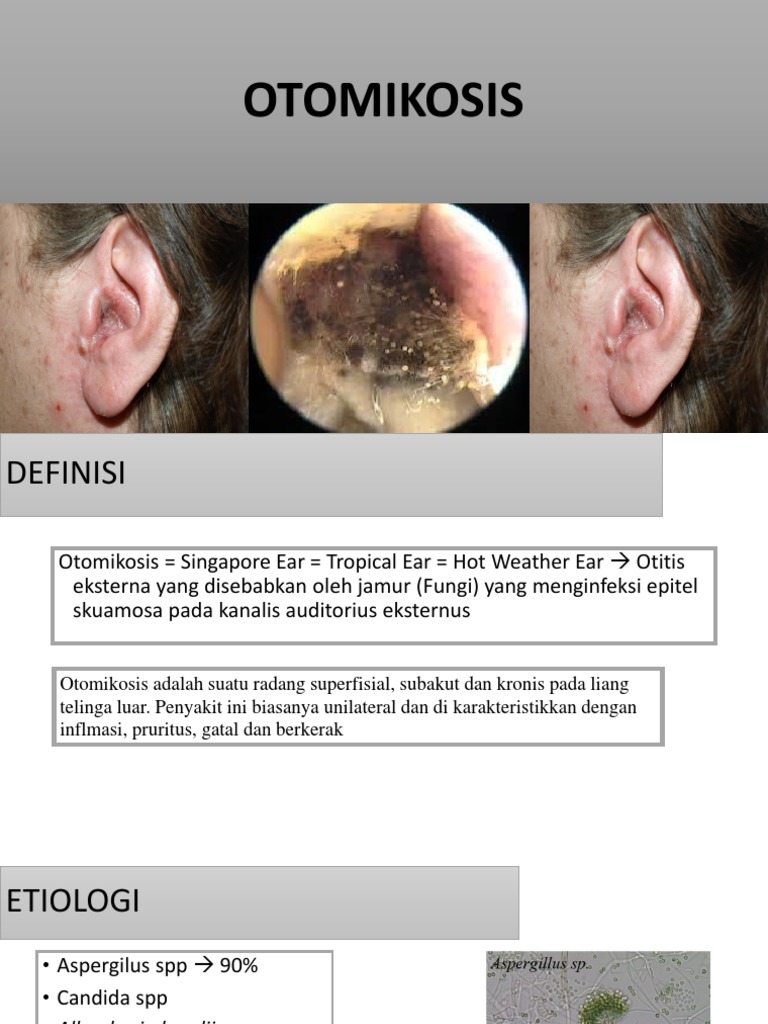Otomikosis | PDF