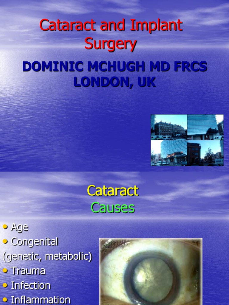 Cataract and Implant Surgery: Dominic Mchugh MD Frcs London, Uk | PDF ...