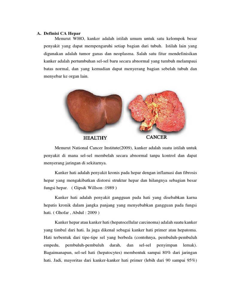 Ca Hepar | PDF