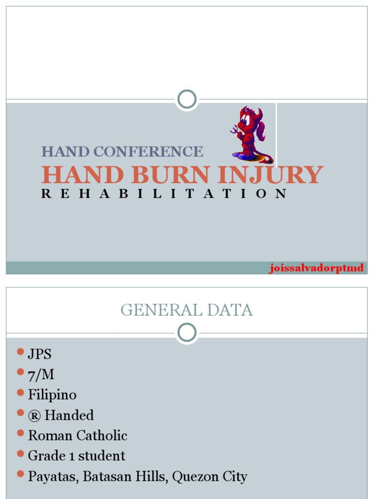 Hand Burn | PDF | Burn | Physical Therapy