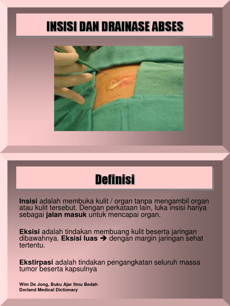 Teknik Insisi dan Drainase Abses | PDF