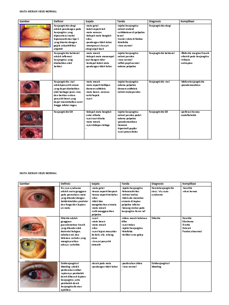 Mata Merah Visus Normal | PDF
