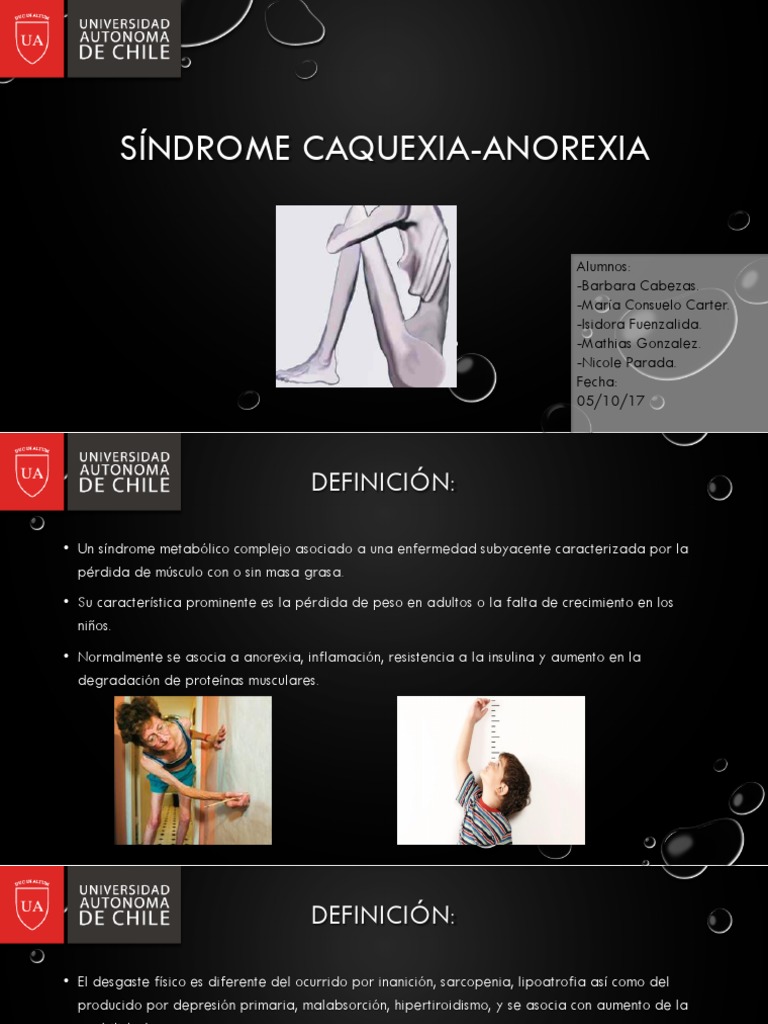 Sindrome Caquexia Anorexia | PDF | Pérdida de peso | Cáncer
