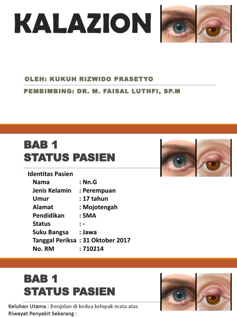 Tatalaksana Kalazion pada Remaja | PDF