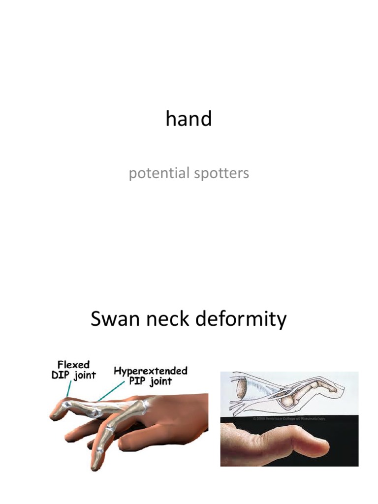 Hand Deformity | PDF | Art
