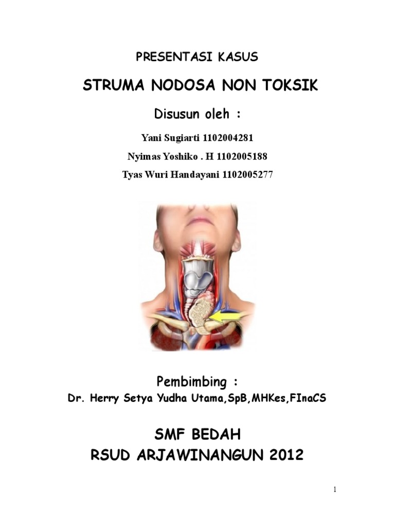 Struma Nodusa Non Toksik | PDF