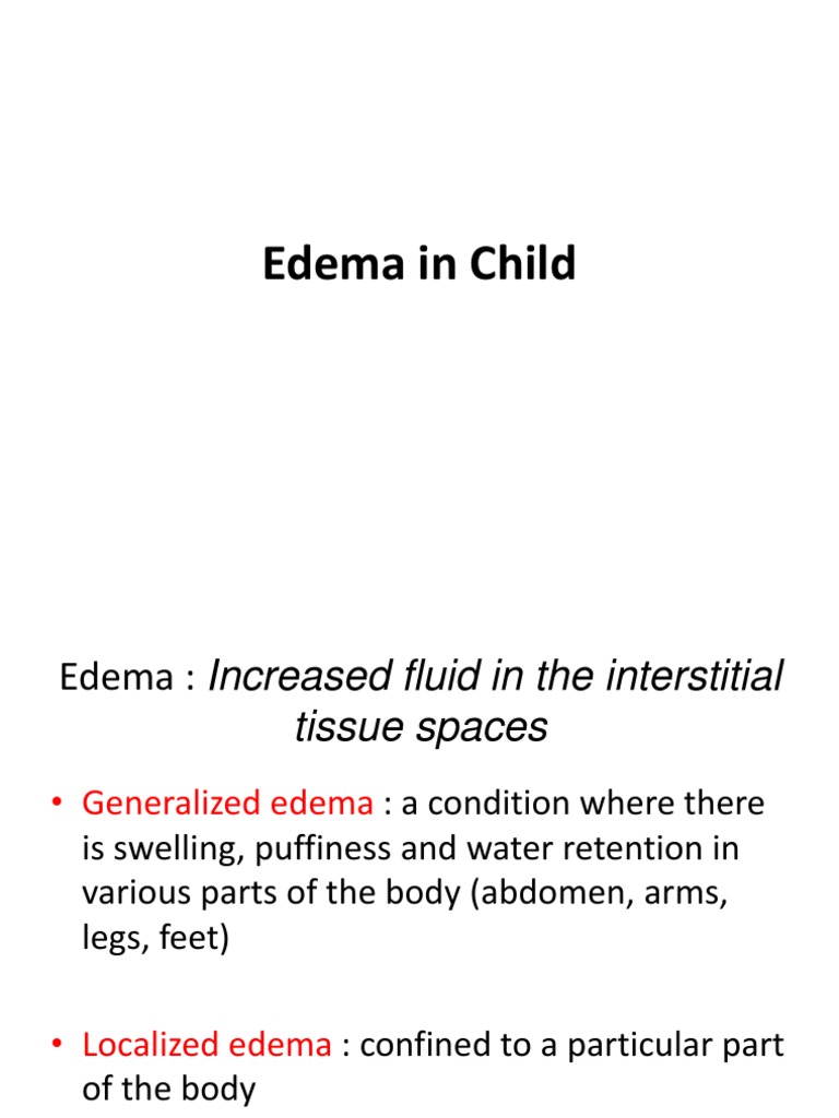 Edema in Child | Edema | Clinical Medicine