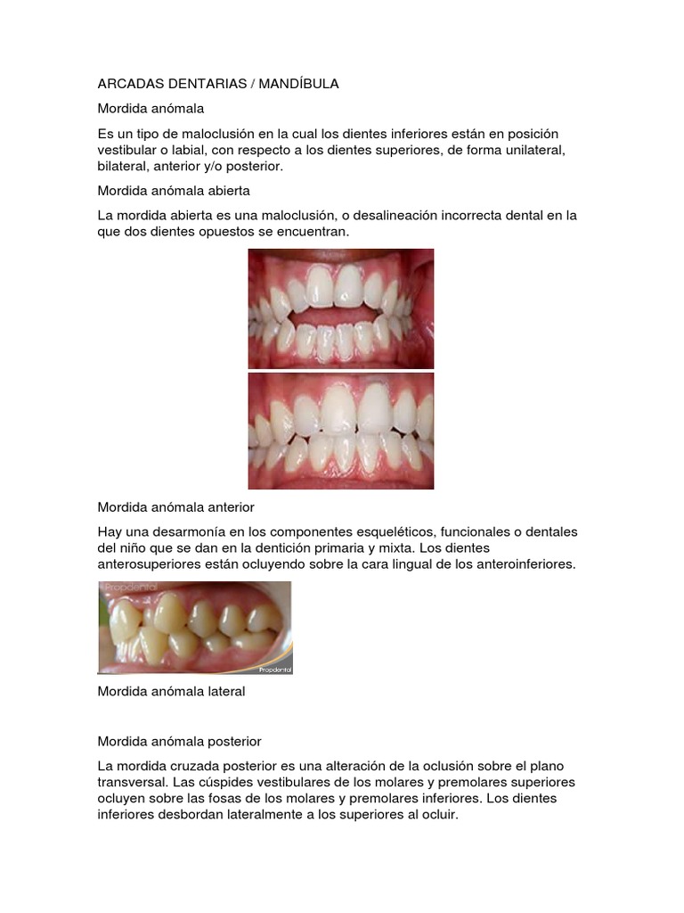 Tipos de Arcadas Dentarias y Maloclusiones | PDF | Diente | Cara