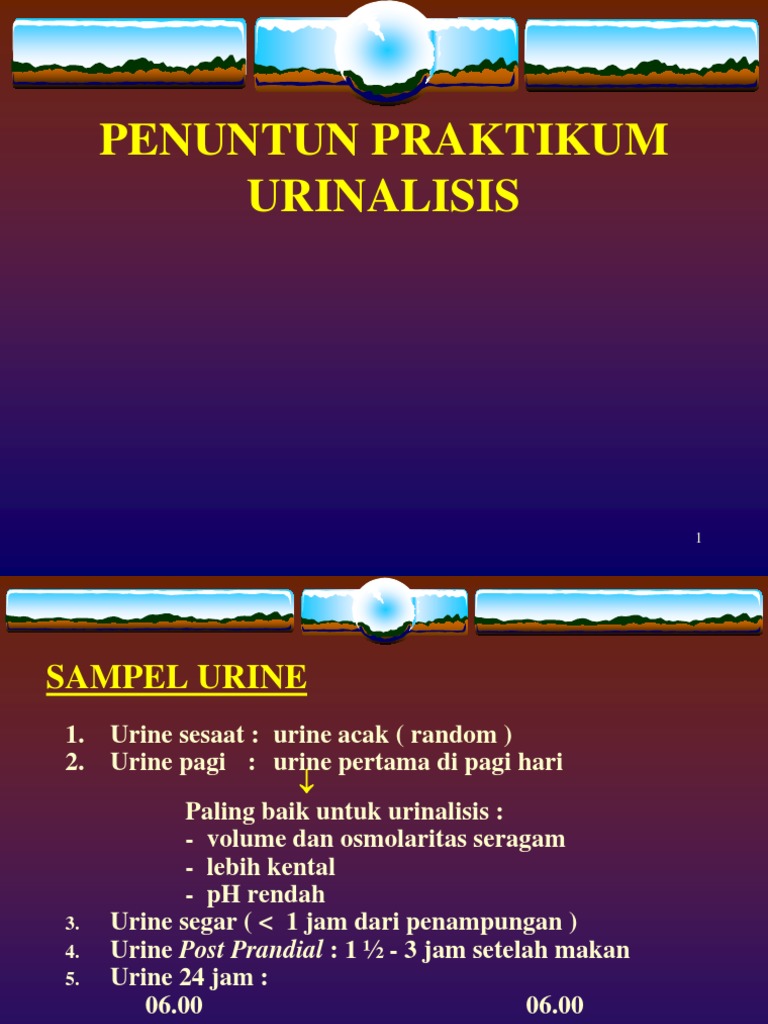 Urinalisa Santa | PDF
