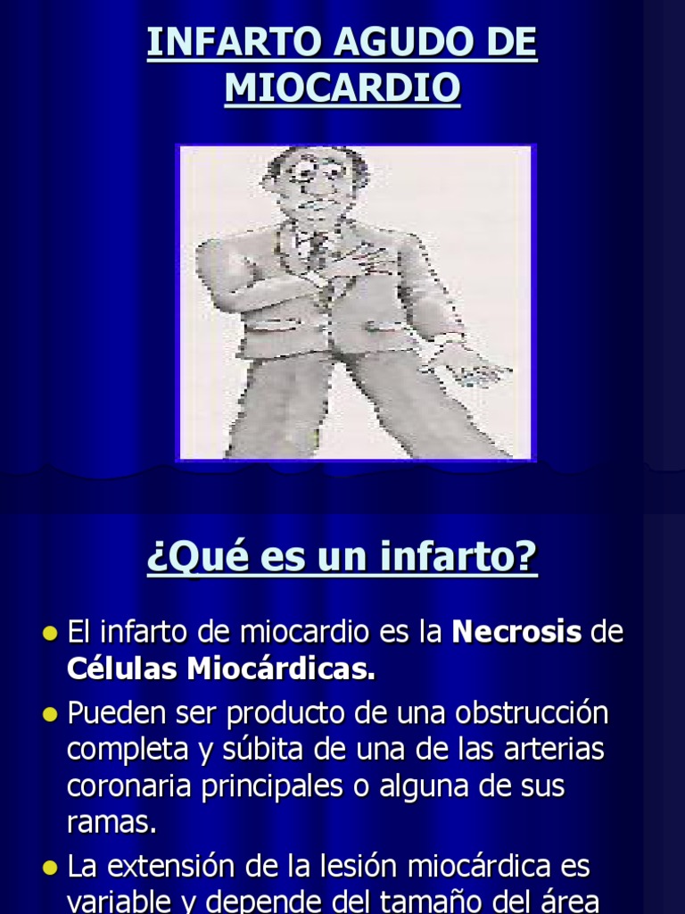 Infarto Agudo de Miocardio | PDF | Infarto de miocardio ...