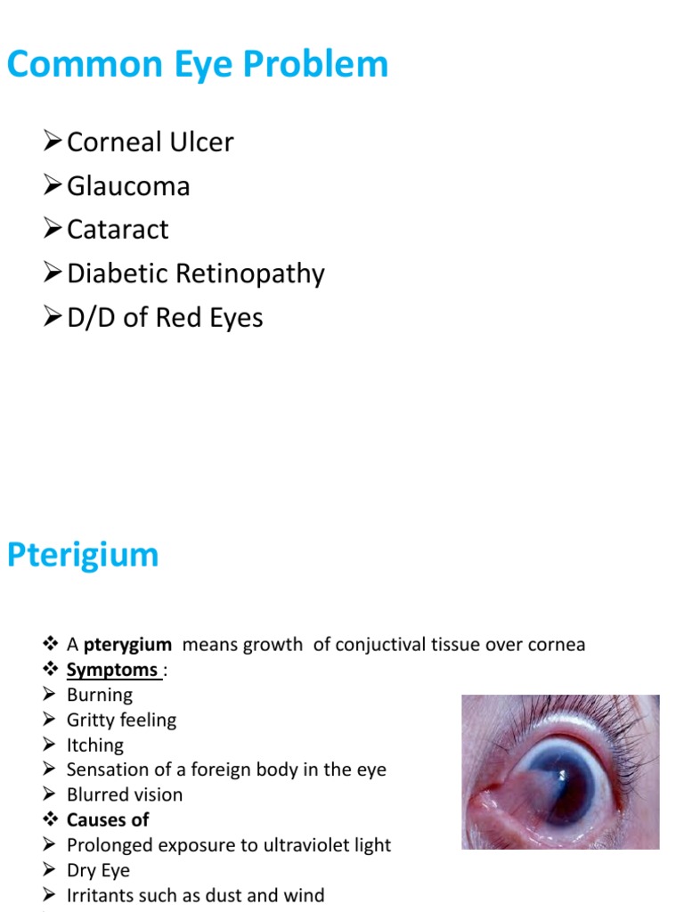 Common Eye Problem Corneal Ulcer, Glaucoma, Cataract, Diabetic ...