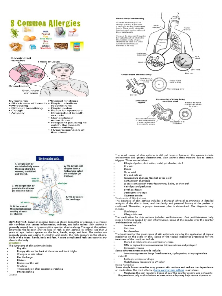 273876894-Skin-Asthma | Dermatitis | Allergy
