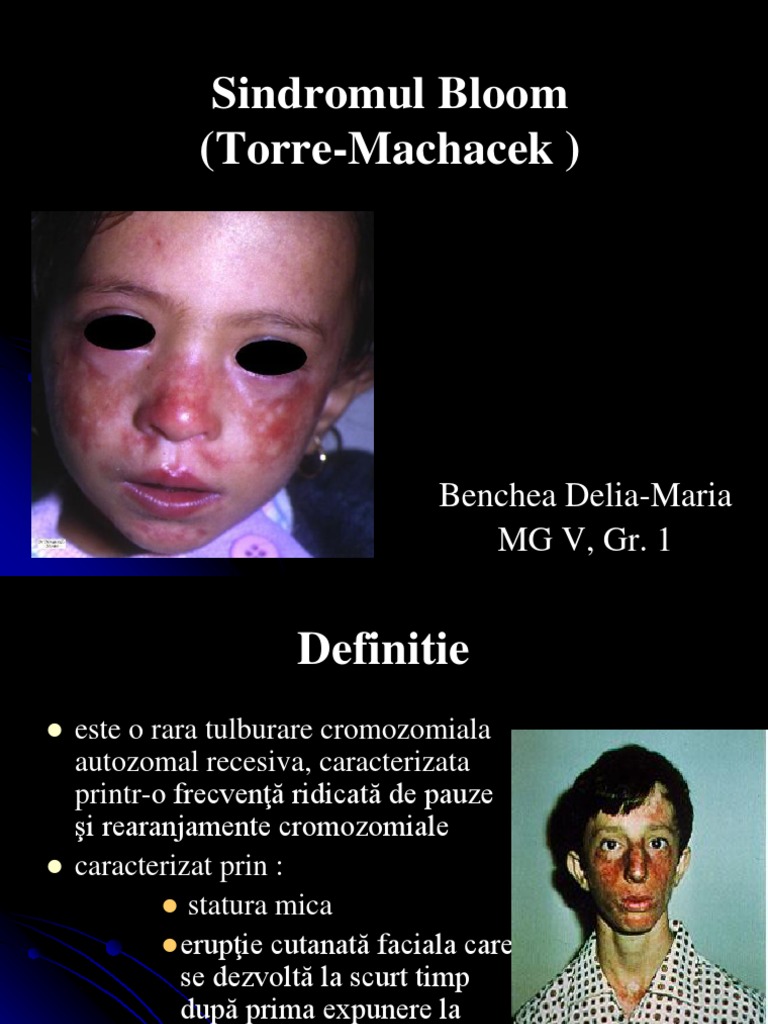 Bloom Syndrome | PDF