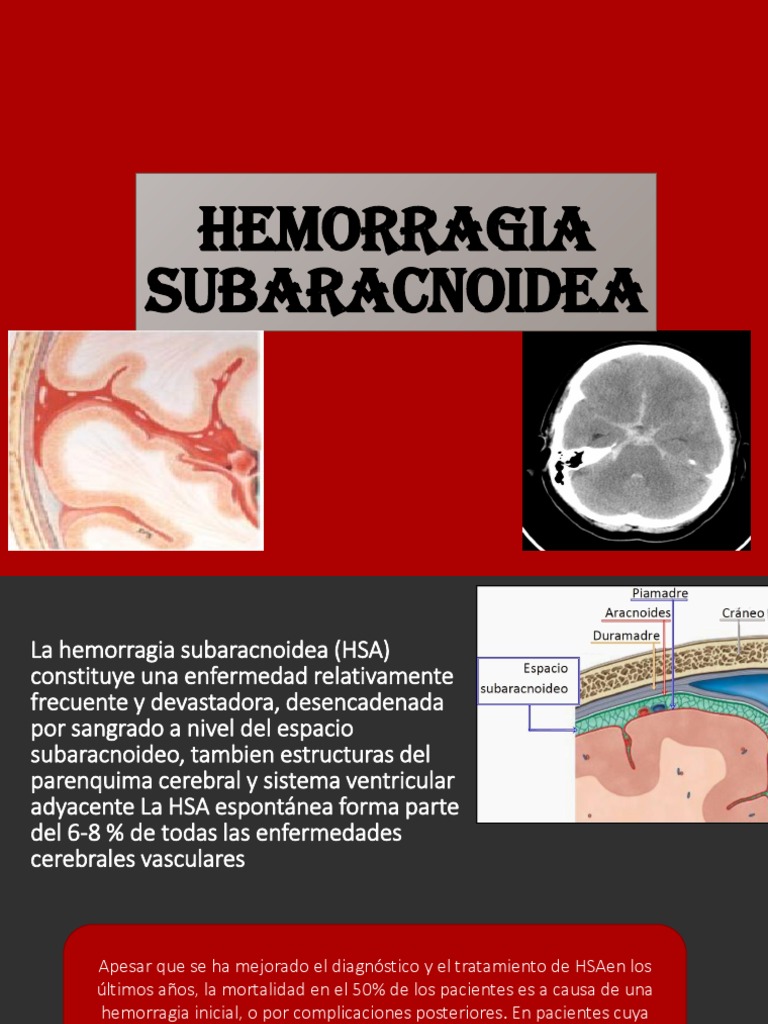 Hemorragia Subaracnoidea | PDF | Angiografía | Angiología