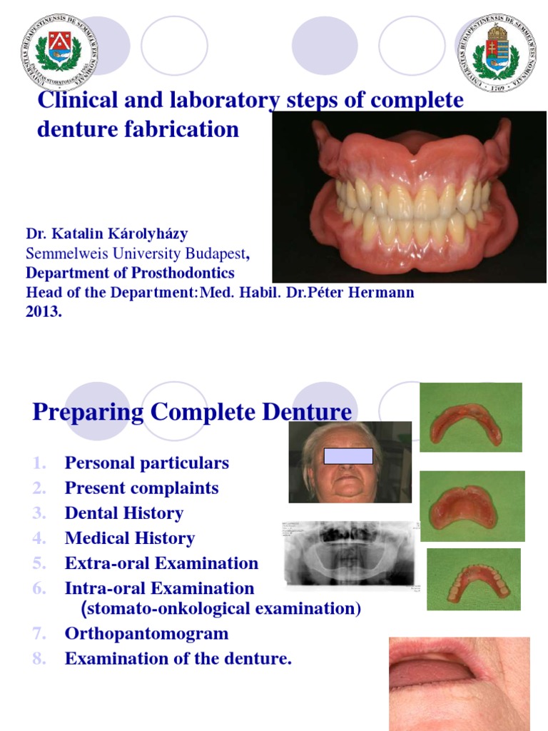 Immediate Dentures Steps