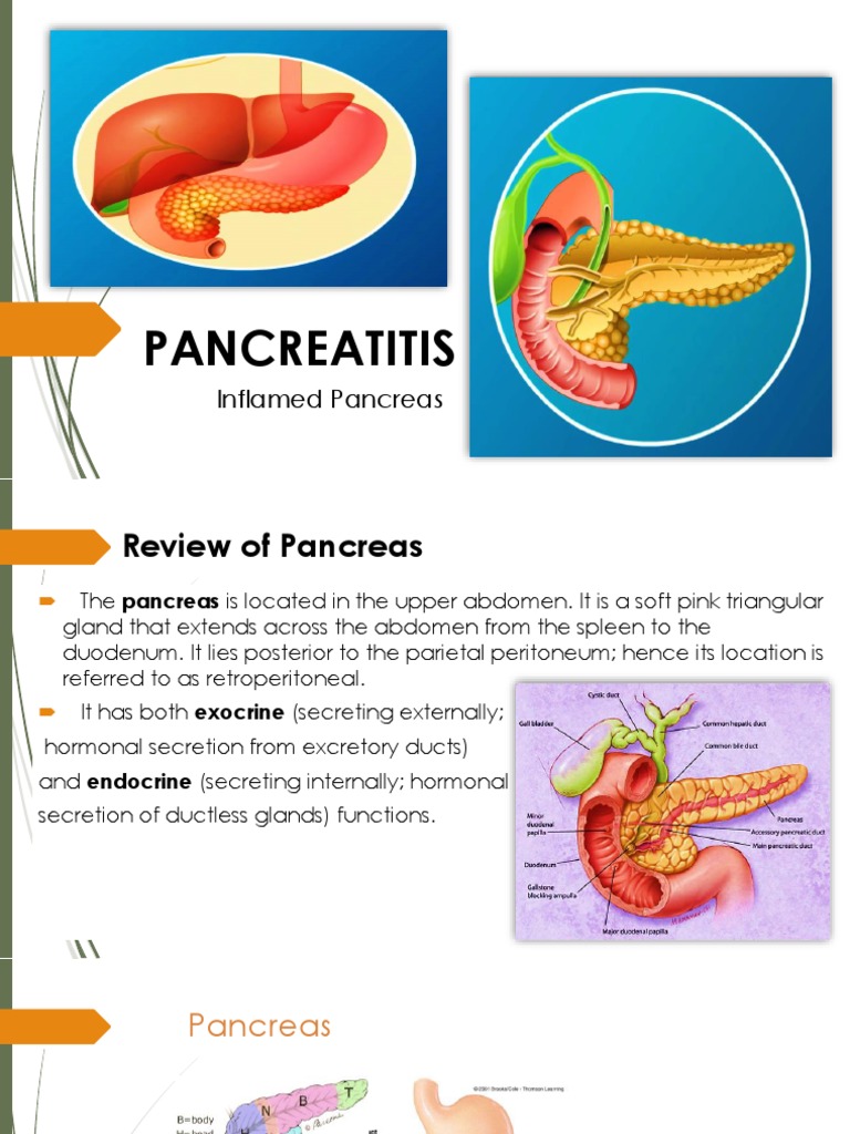 Acute Pancreatitis | PDF | Pancreas | Gastroenterology